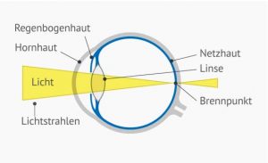 Hornhautverkrümmung - geeignet für Laser-OP? - Augenzentrum Eckert